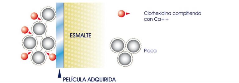 Chlorhexidine (CHX) | Dental Plaque | Perio Expertise