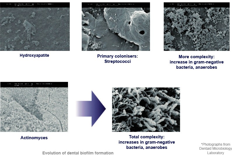 Oral biofilm formation | Perio Expertise